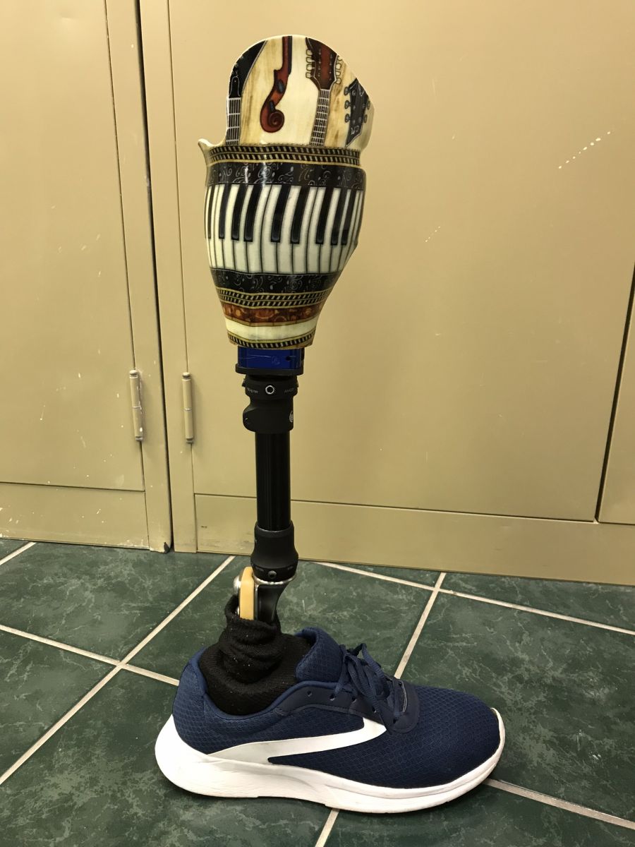 Image Gallery - Prosthetic & Orthotic Services | Arkansas